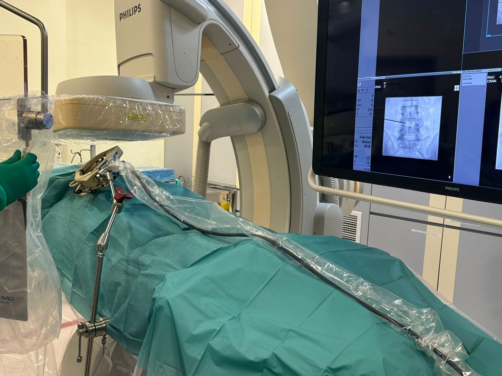 Discoplasty - Non-Invasive and Less Invasive Spine Day Procedures ...